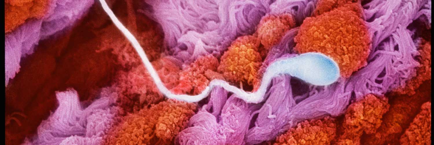 ESHRE 2024 Abstract submissions - Focus on Reproduction - ESHRE